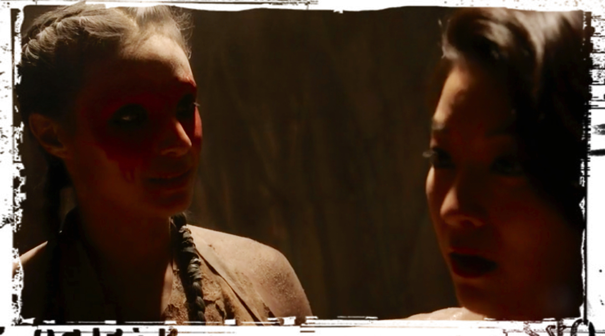 Kira treated by skinwalker Teen Wolf Codominance | The Supernatural Fox ...